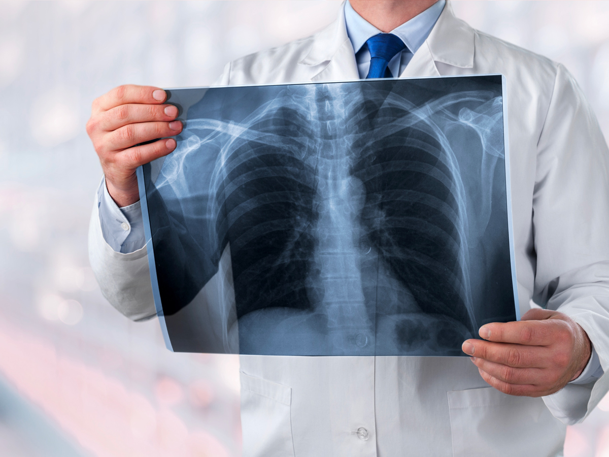 Broncopneuomologo ad Anguillara Sabazia - Centro Diagnostico Sabatino