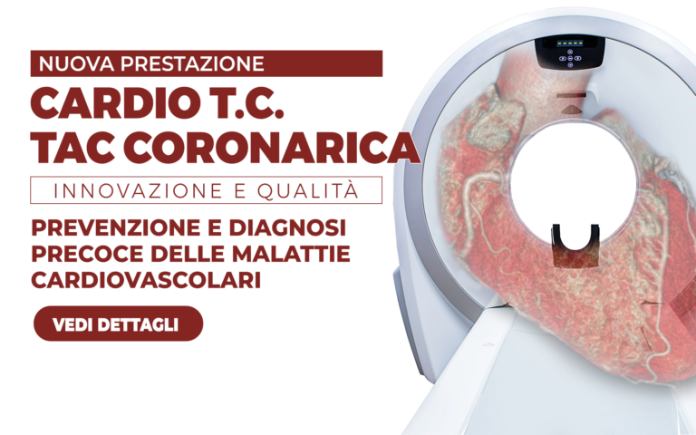 Cardio TC - TAC al Cuore a Roma - TC Coronarica